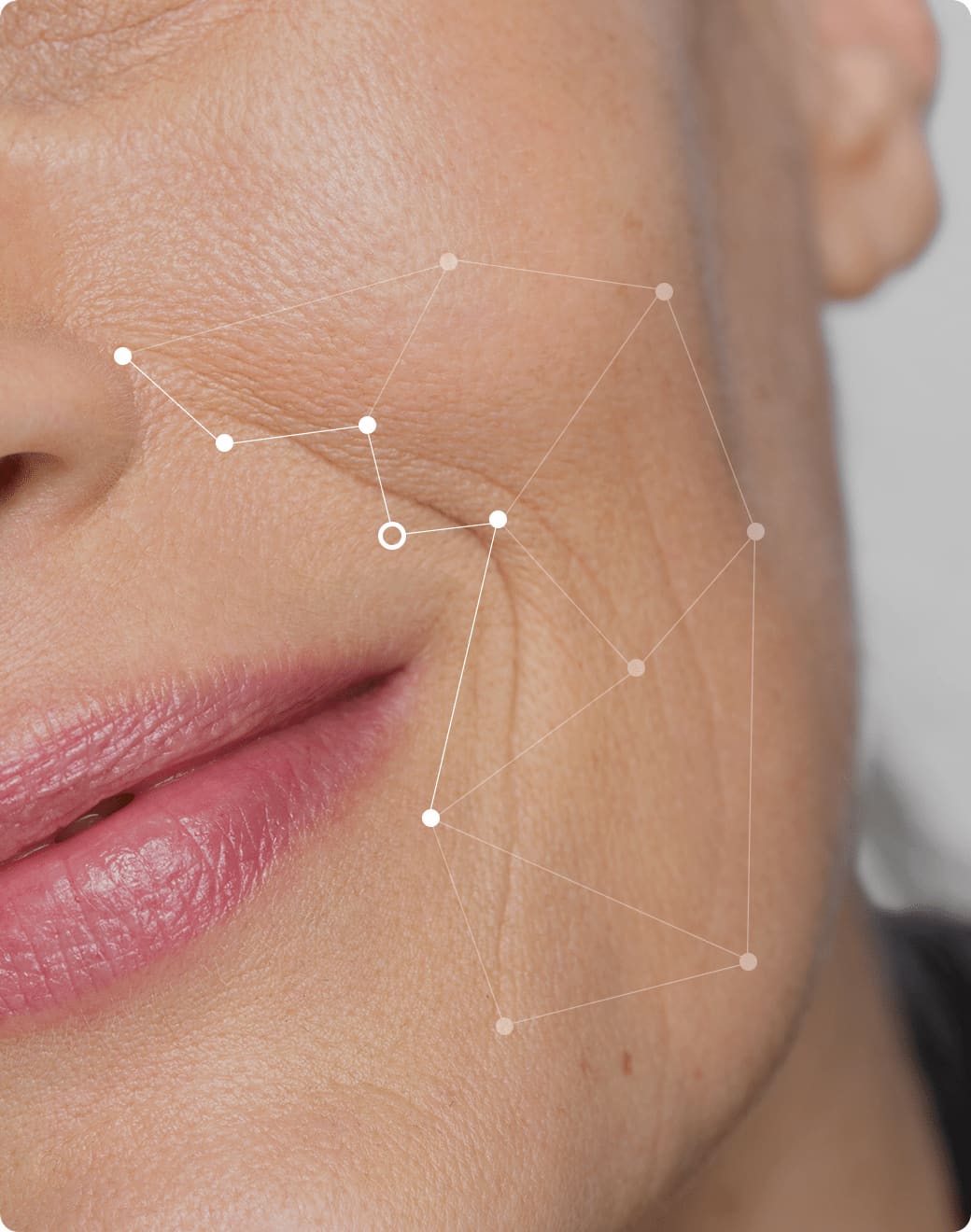 SkinConsult AI explanations