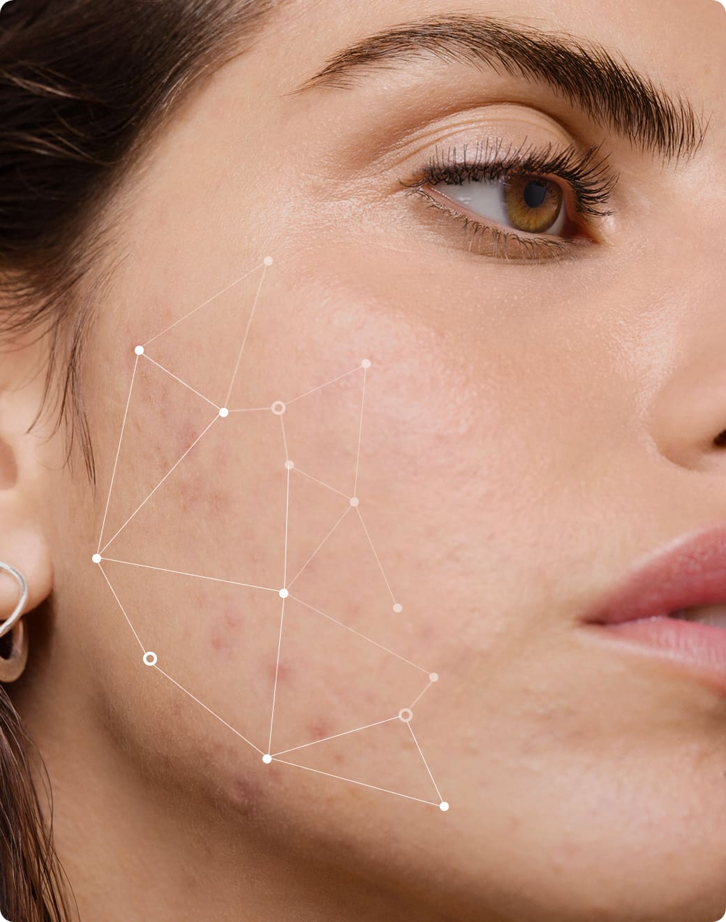 SkinConsult AI explanations